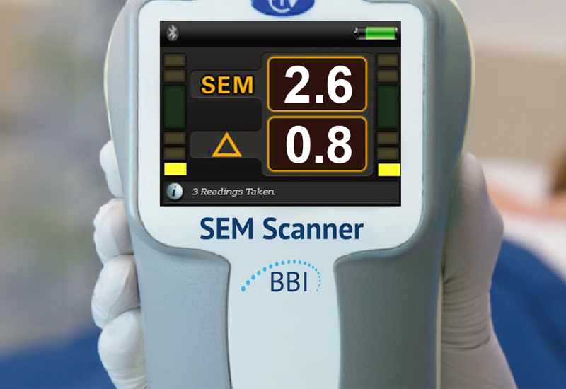 Pressure ulcer scanner gets top tech assessment from NICE