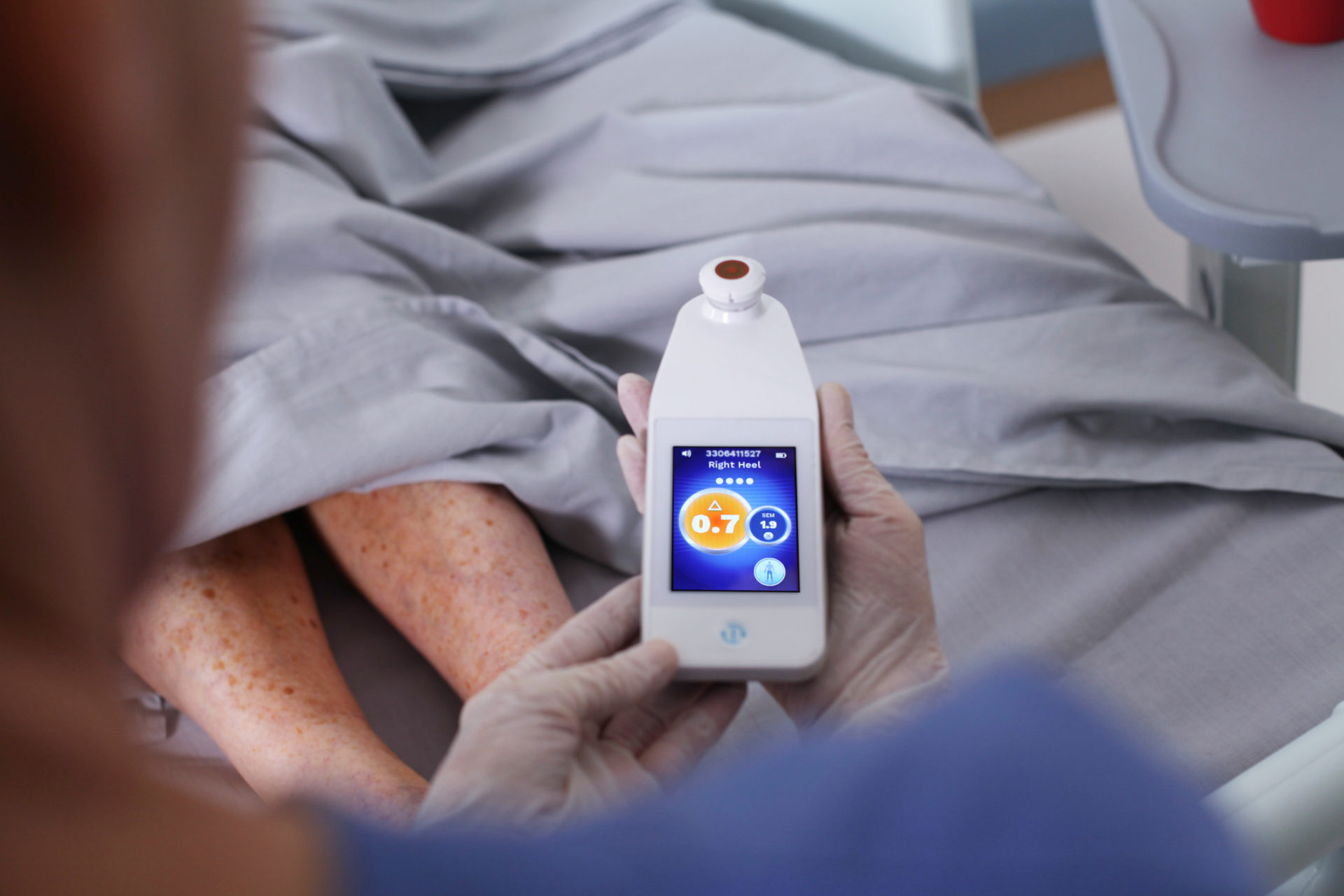Device launched to deliver 'step in change' in pressure ulcer prevention