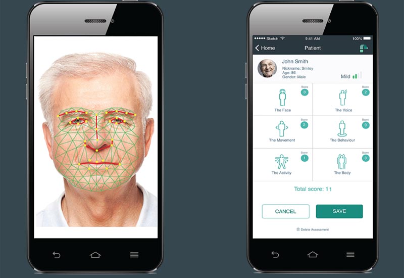 Pain assessment tool for dementia patients launches in the UK