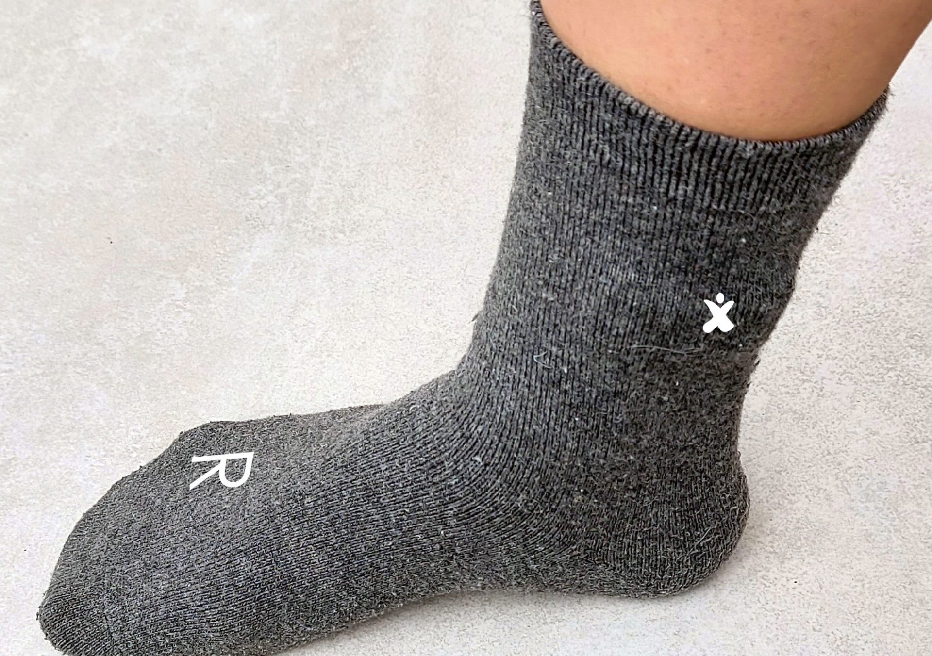 'Smart socks' invented to help millions with dementia